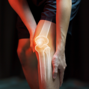 Understanding Counterforce Braces: What They Do (and Don’t Do) – Dr ...